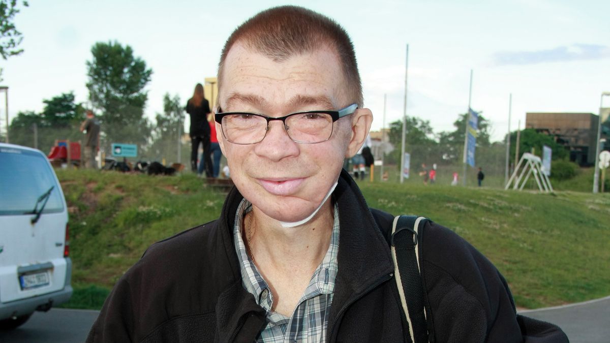 Dětská hvězda Michael Hofbauer: Nádor ho připravil o chuť, zuby i sliny ...