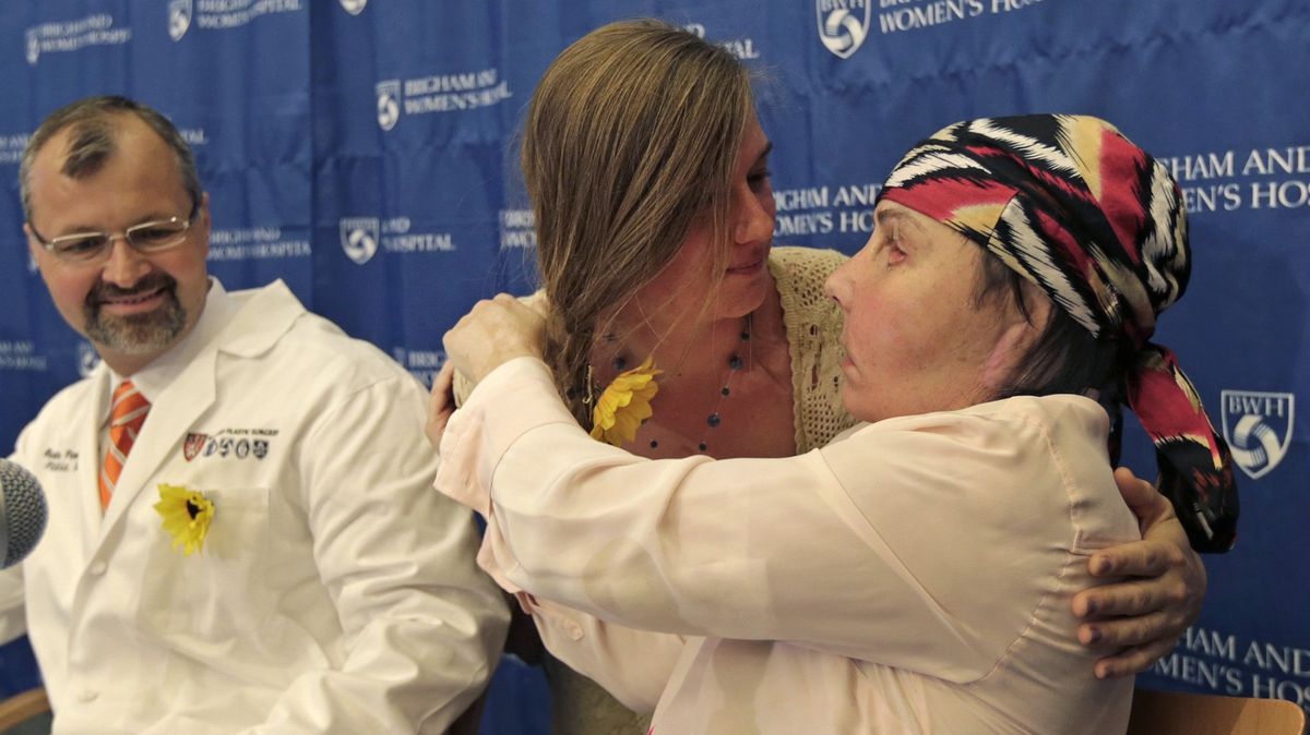 Bývalý manžel jí polil tvář louhem a málem ubil k smrti. Český chirurg Bohdan Pomahač jí vrátil ...